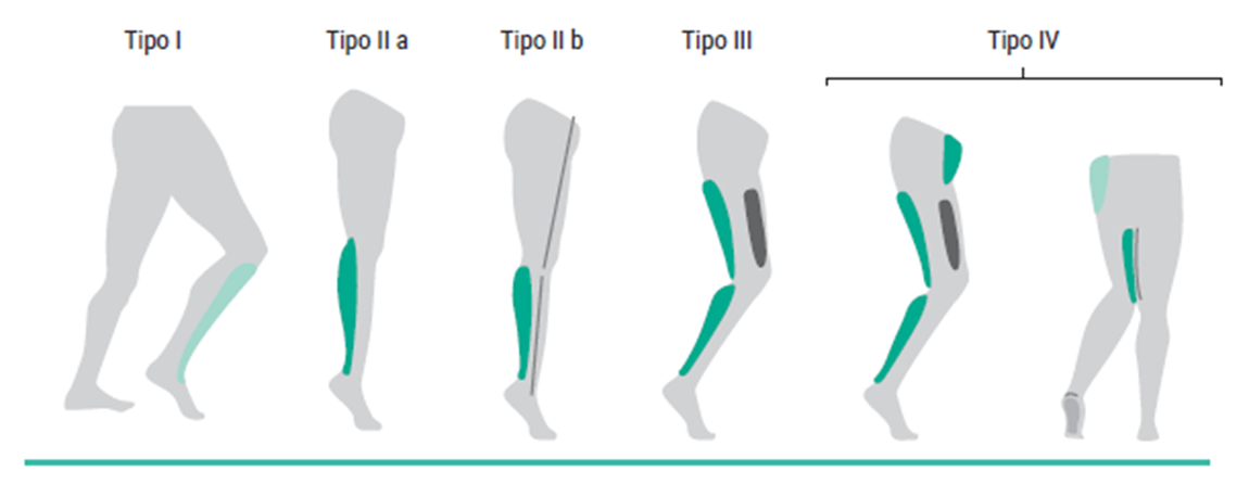 Clasificación de la marcha en niños con daño neurológico – InvestigaFisio