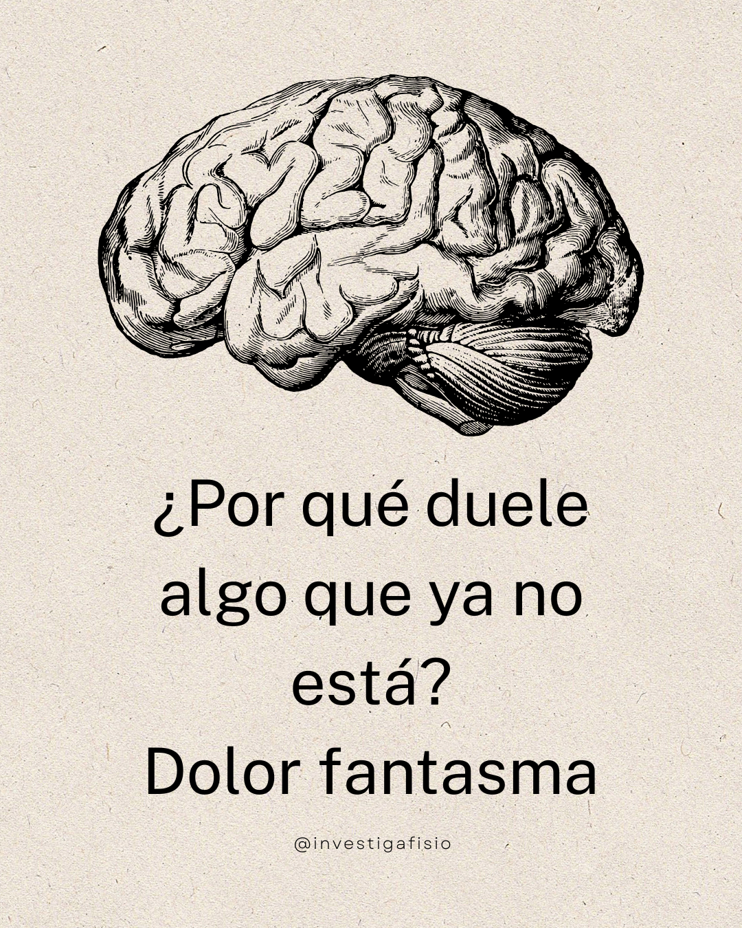 ¿Por qué duele un miembro que ya no está? Lo que el dolor fantasma nos ...